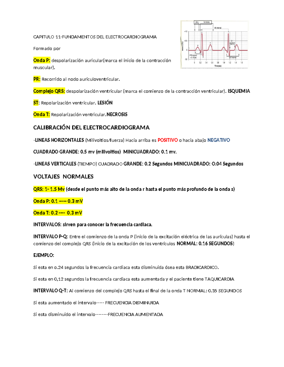 Electro - CAPITULO 11-FUNDAMENTOS DEL ELECTROCARDIOGRAMA Formado por Onda P: despolarización ...