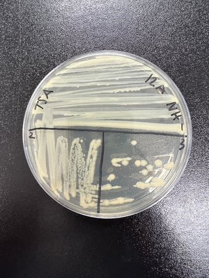 Microbiology exam I - Less than 10% of microbes are pathogenic 90% of ...