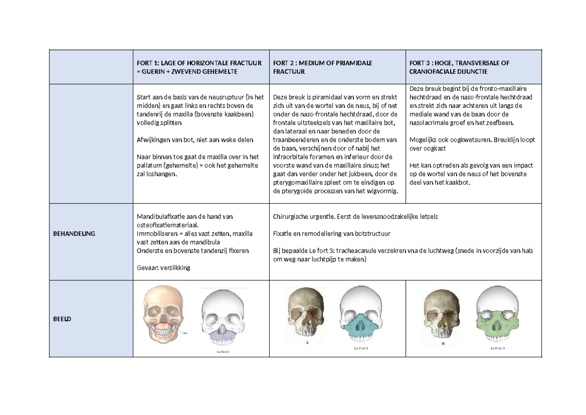 Schema fort - FORT 1: LAGE OF HORIZONTALE FRACTUUR = GUERIN + ZWEVEND ...