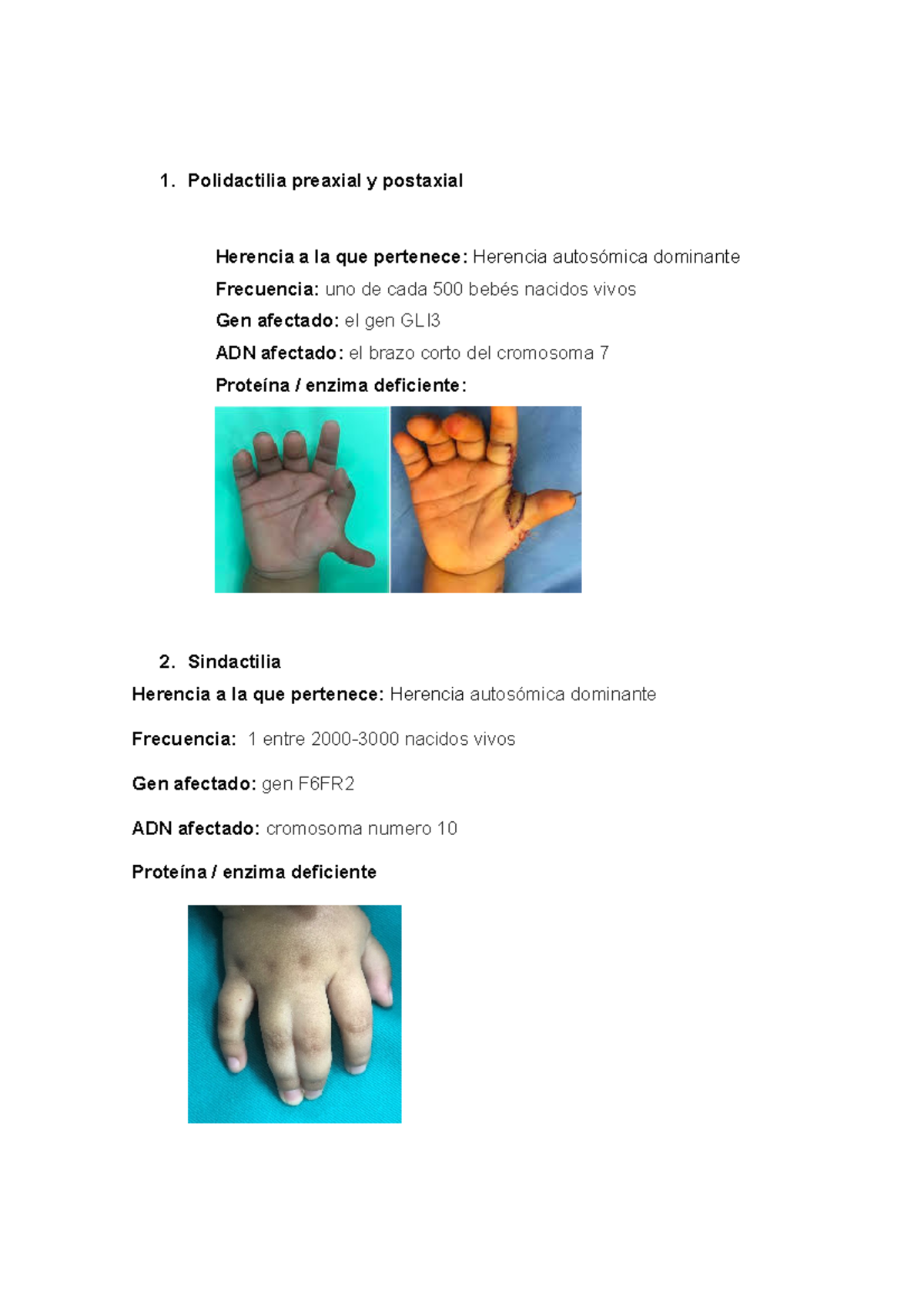 Enfermedades hereditaria - Polidactilia preaxial y postaxial Herencia a ...