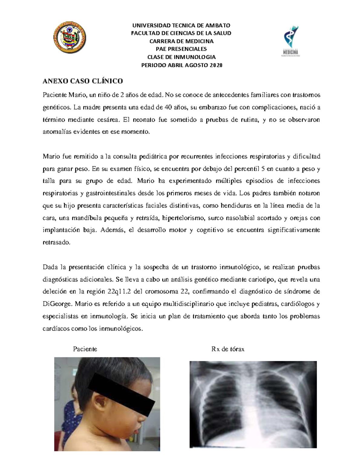 CASO Clínico Aplasía Tímica Congénita - FACULTAD DE CIENCIAS DE LA ...