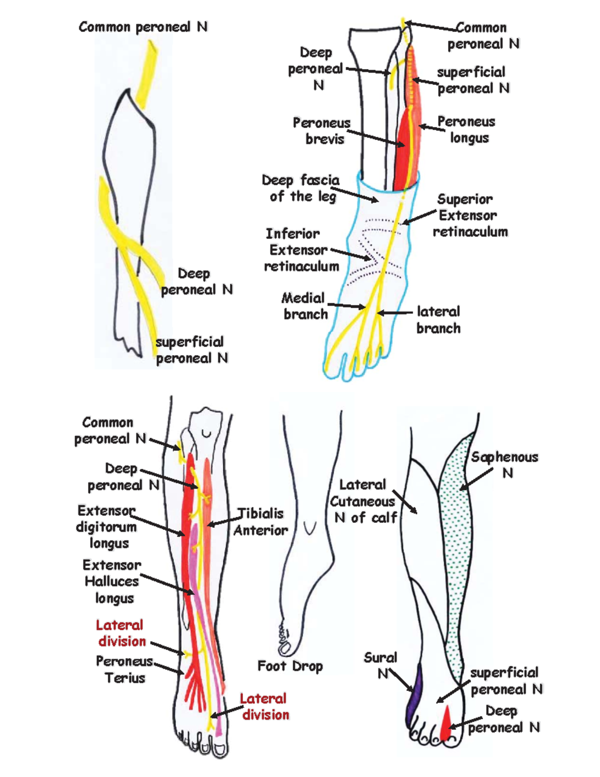 Lower limb 4 - Common peroneal N DeepDeep peroneal N ...