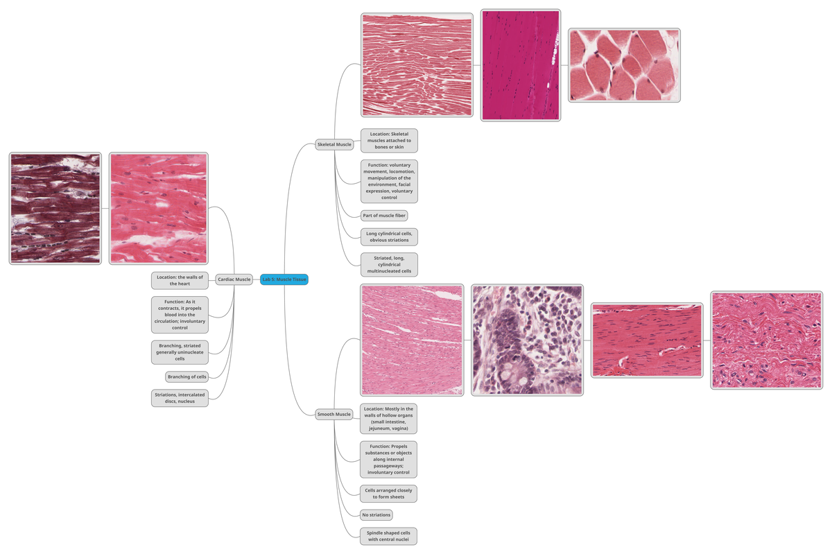 Lab 5 Mindmap - Location: the walls of Cardiac Muscle Lab 5: Muscle ...