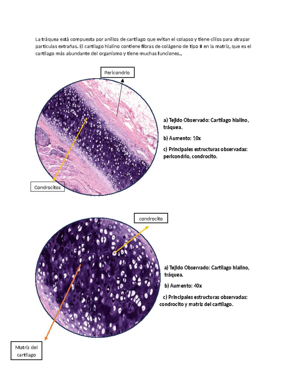 Tejido conectivo.docx love - Pericondrio La tráquea está compuesta por ...