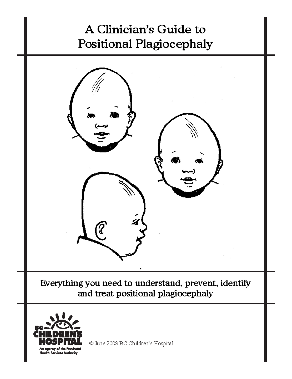Plagiocephaly - Everything you need to understand, prevent, identify ...