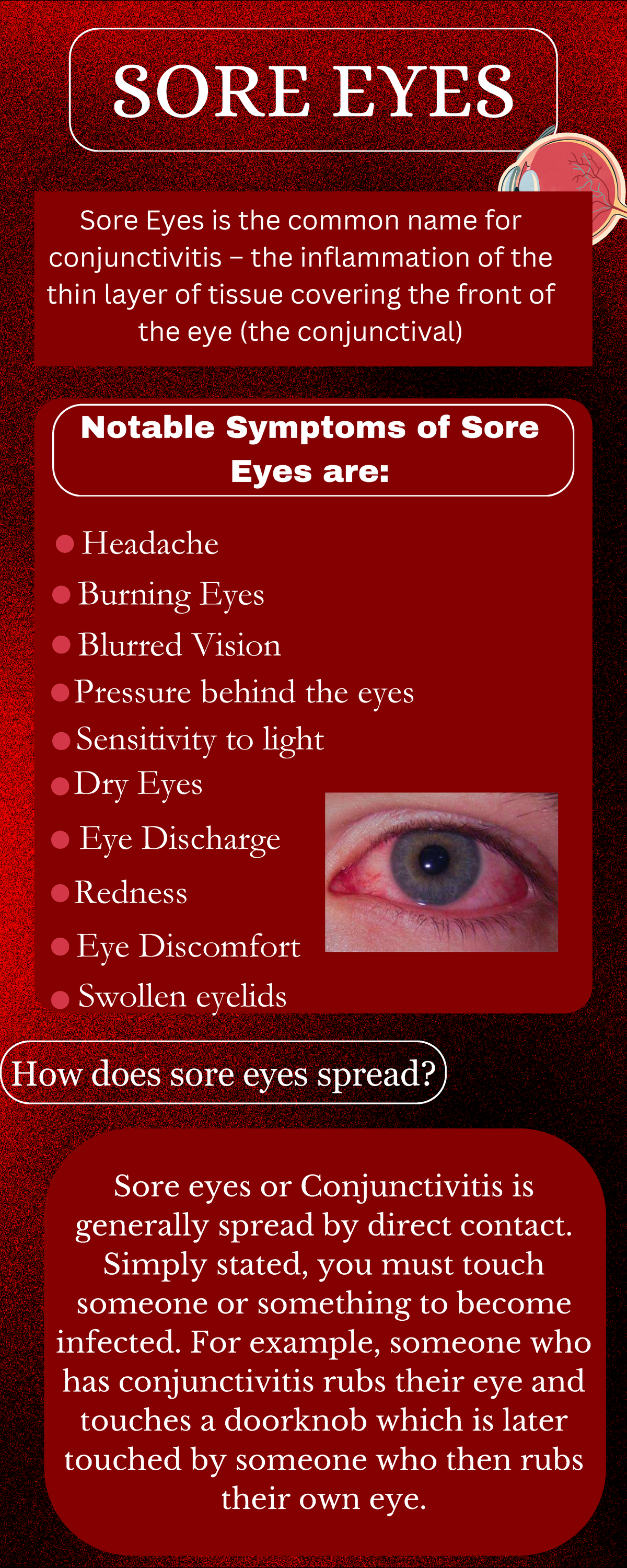 SORE EYES - this is mapehth - Notable Symptoms of Sore Eyes are ...