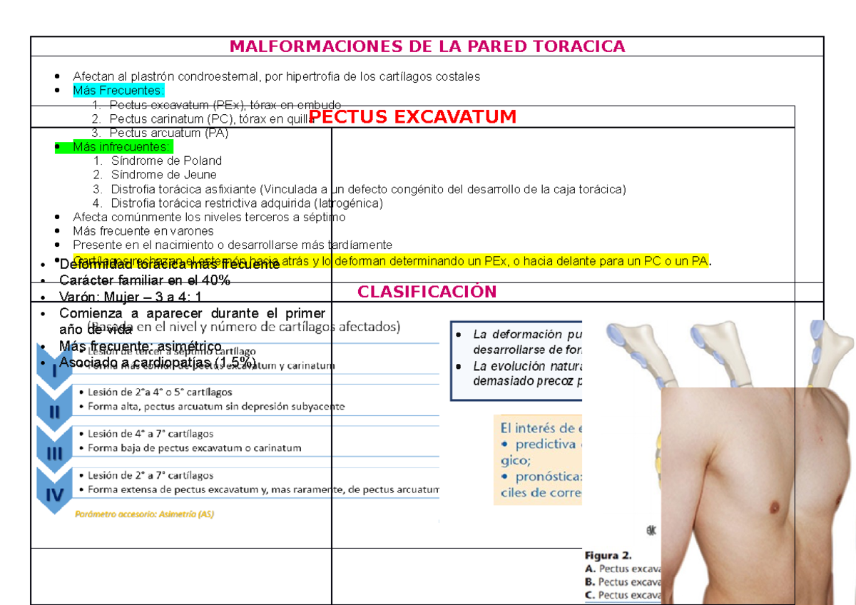 Malformaciones DE LA Pared Toracica - MALFORMACIONES DE LA PARED ...