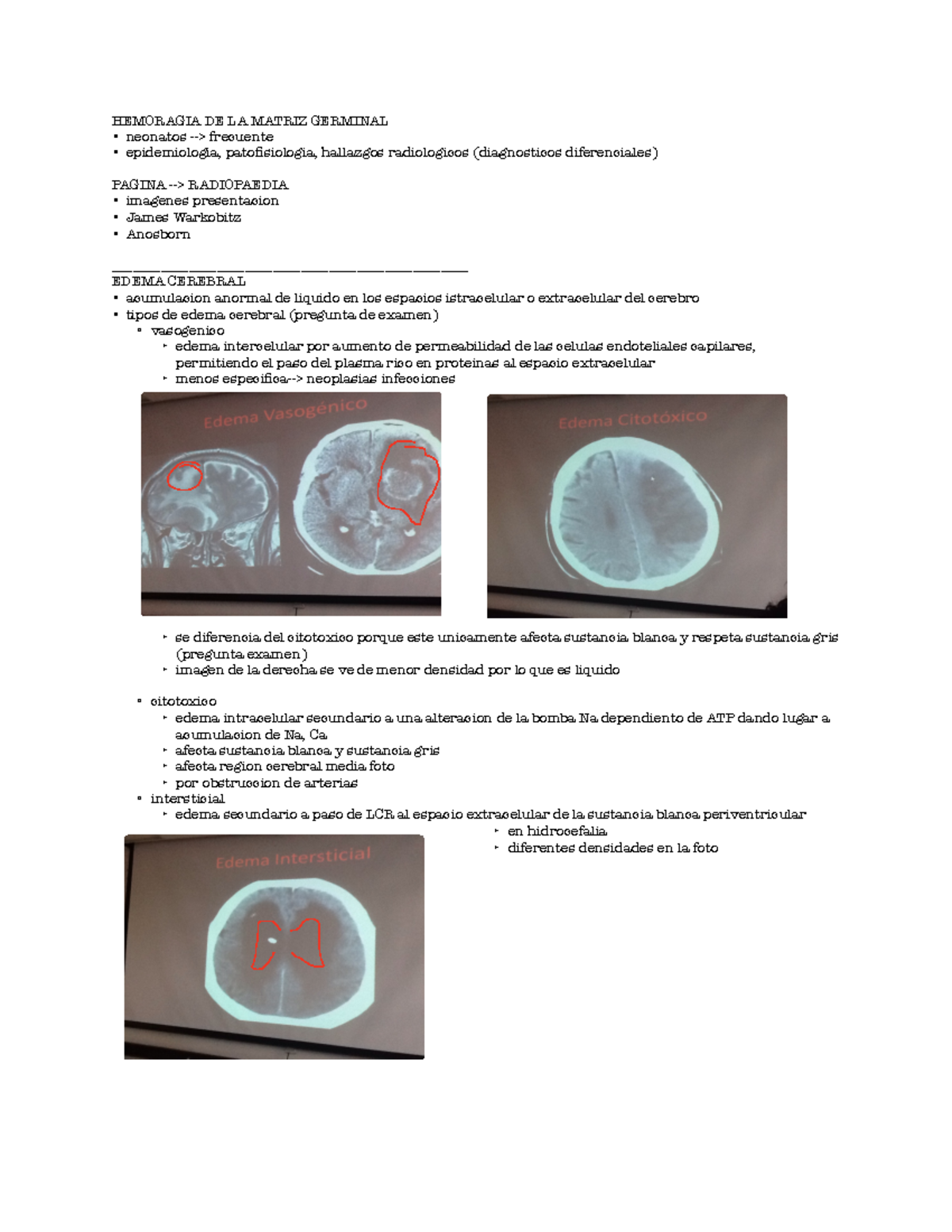 10. Patologia isquemica del SNC - HEMORAGIA DE LA MATRIZ GERMINAL ...