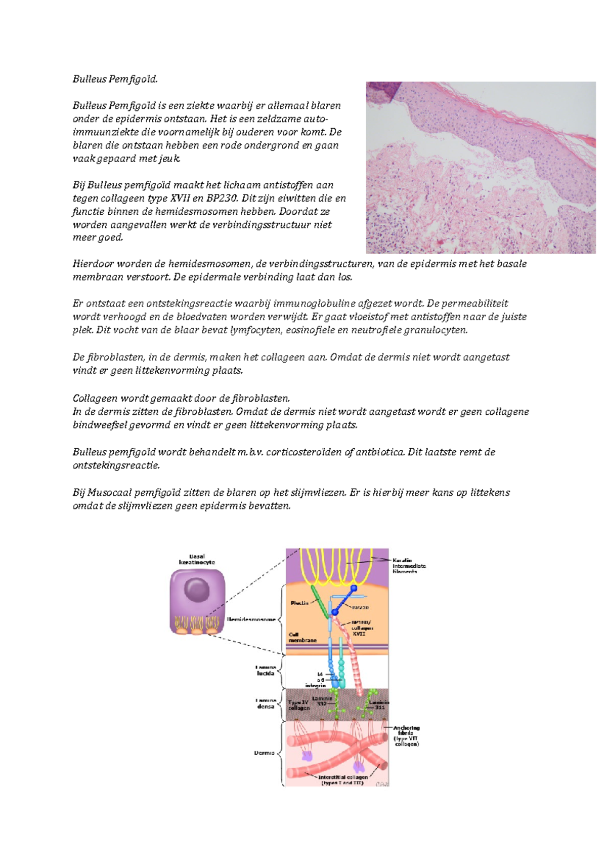 Bulleus Pemfigoïd wg2 casus 1a - Bulleus Pemfigoïd. Bulleus Pemfigoïd ...