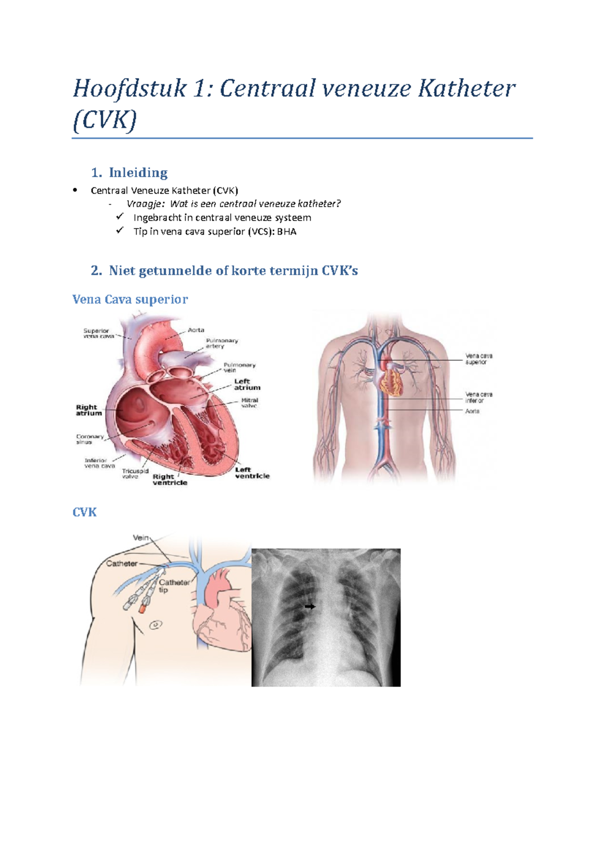VDI plus samenvatting - Hoofdstuk 1: Centraal veneuze Katheter (CVK) 1 ...