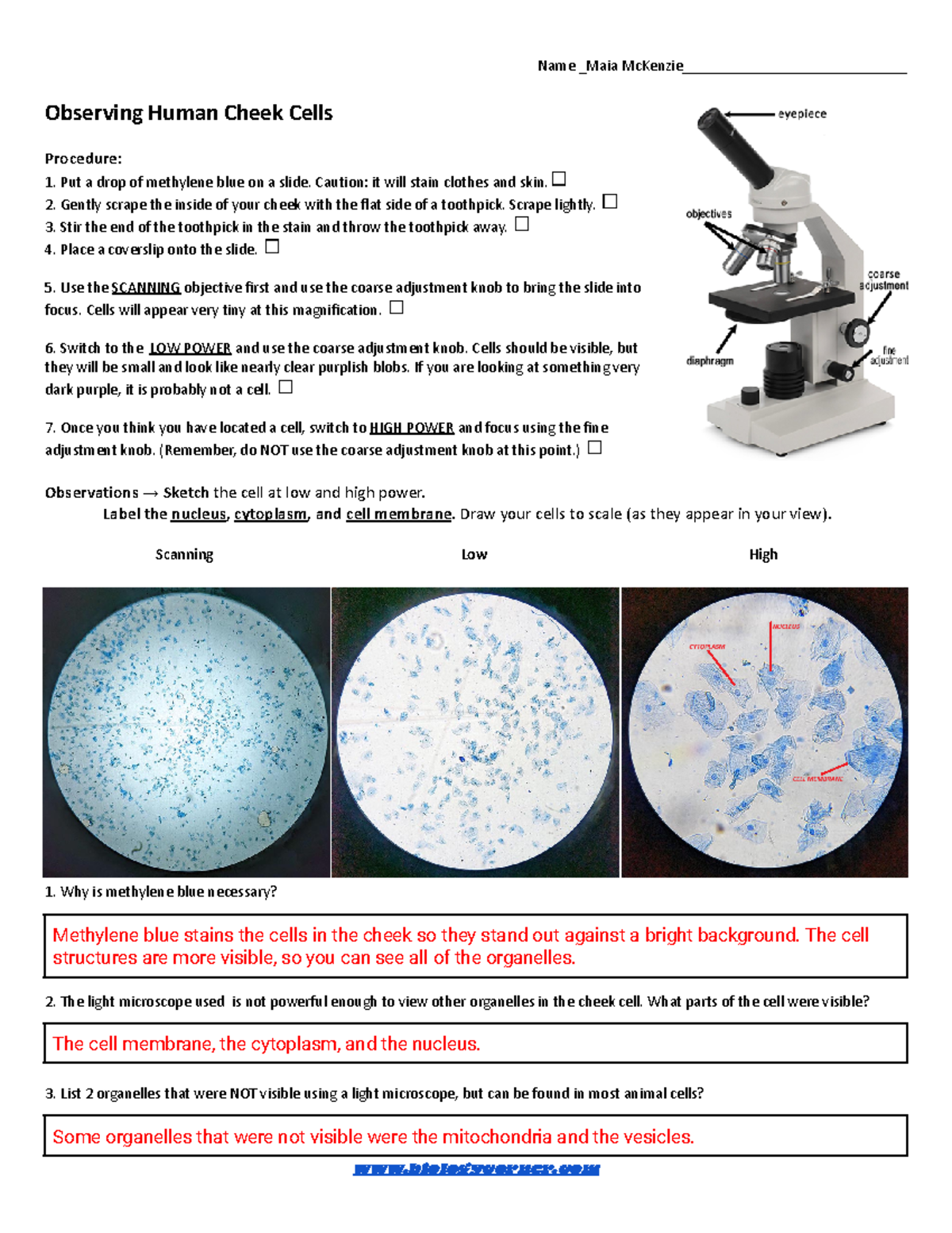 Investigation Human Cheek Cell - Name Maia McKenzie ...