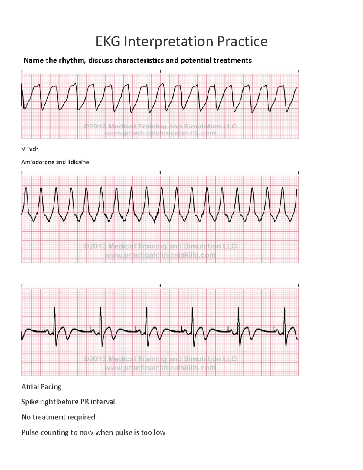EKG Interpretation Practice - Pulse counting to now when pulse is too ...