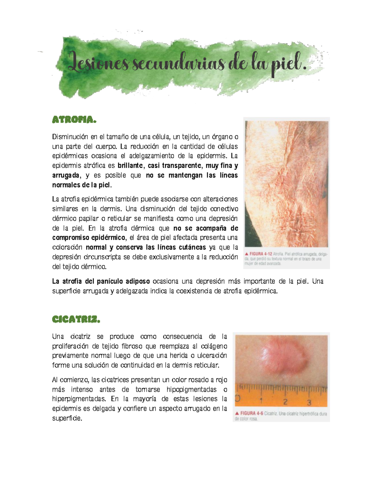 Lesiones secundarias de la piel - ATROFIA. DisminuciÛn en el tamaÒo de ...