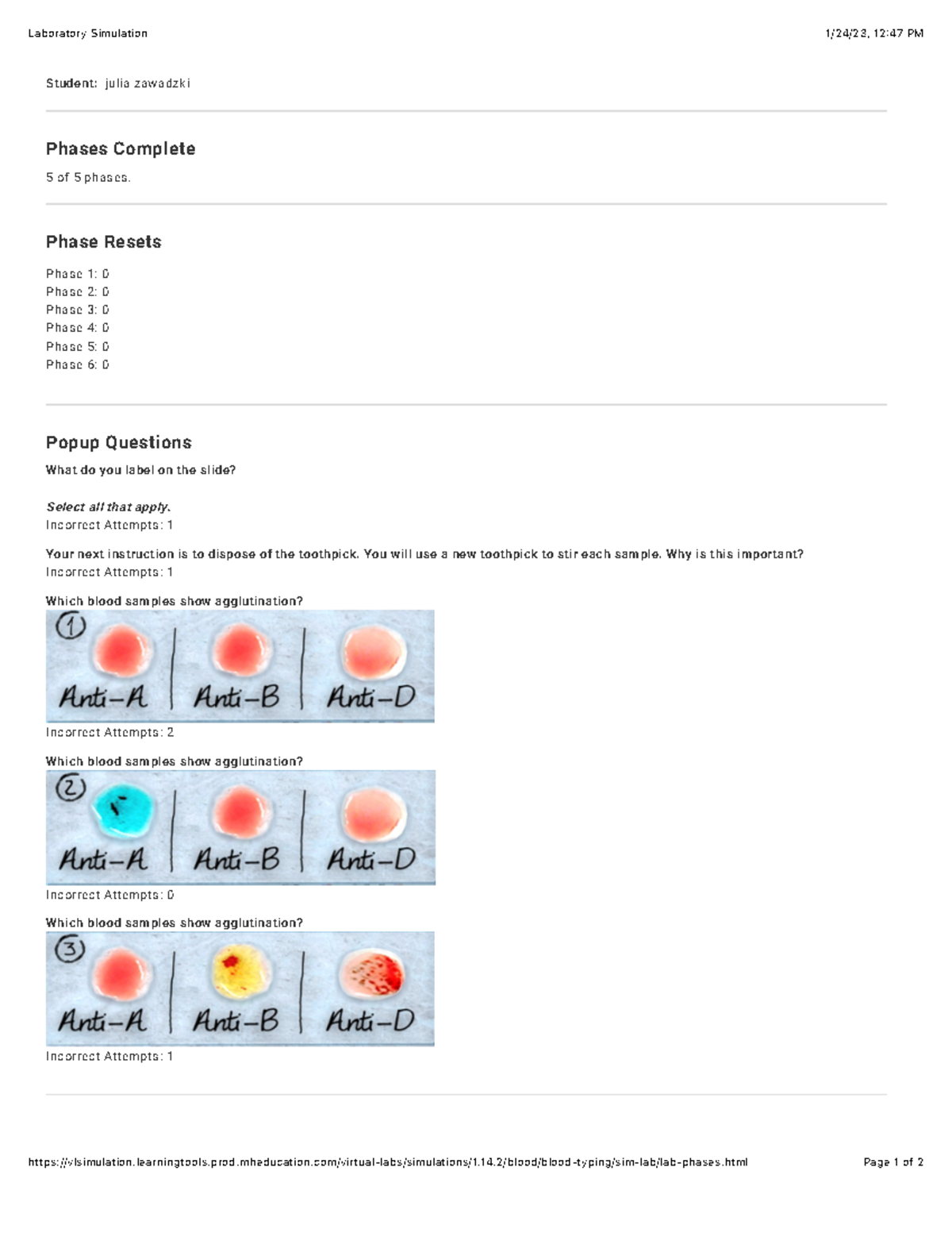 Blood typing - Laboratory Simulation 1/24/23, 12:47 PM - Studocu