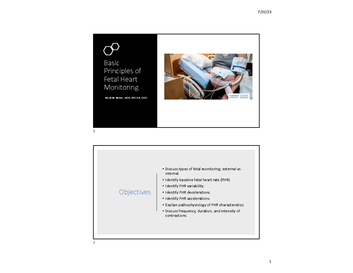 Basic Principles of EFM Wi21 - Basic Principles of Fetal Heart Monitoring Nicolette Baines, MSN ...