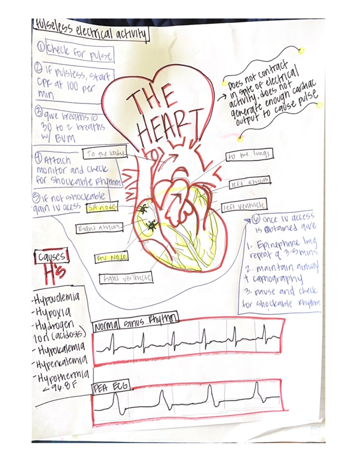 The Sketch noting sim pcc4 cardiac PEA - fulseless electrical activity ...