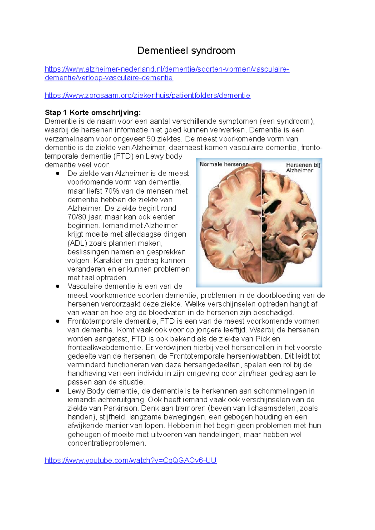 Uitgebreide omschrijving van het ziektebeeld Dementieel Syndroom ...
