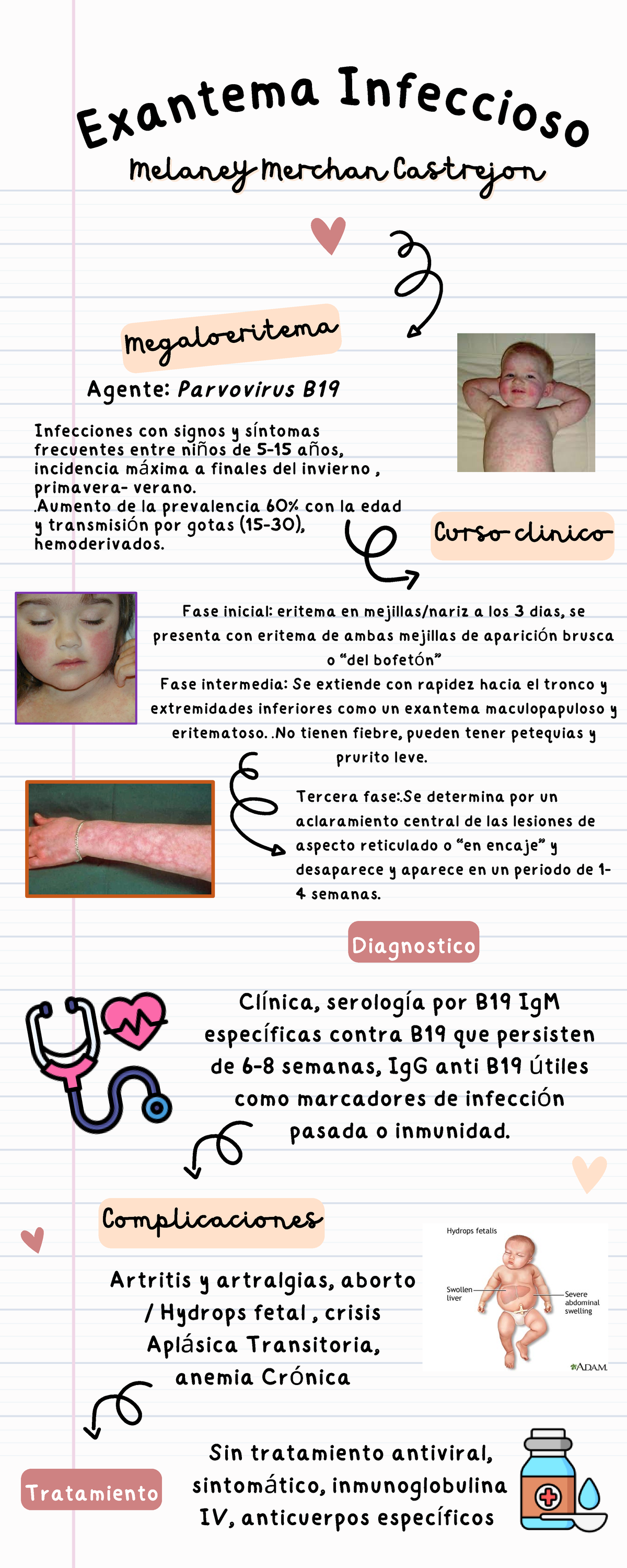 Exantema Infeccioso - Artritis y artralgias, aborto / Hydrops fetal ...