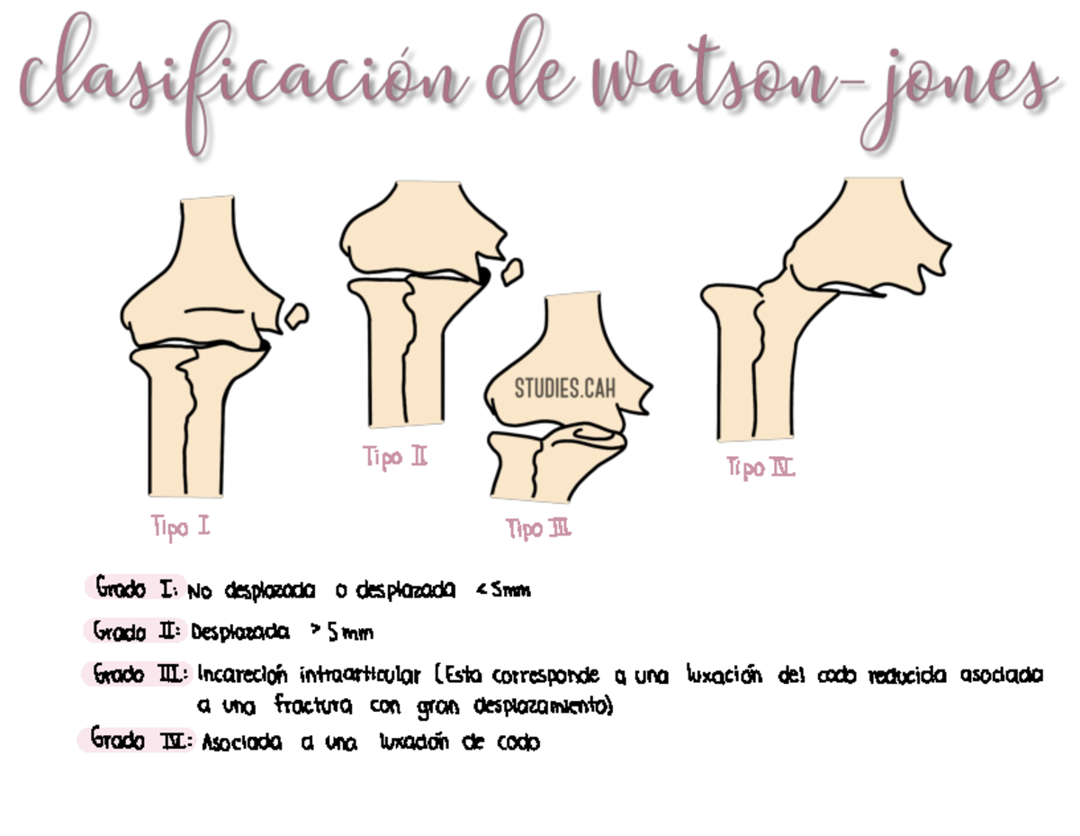 Clasificación de Watson-Jones 2 - : B - E J ' T : n O ÷ • o ° E A- O E ...