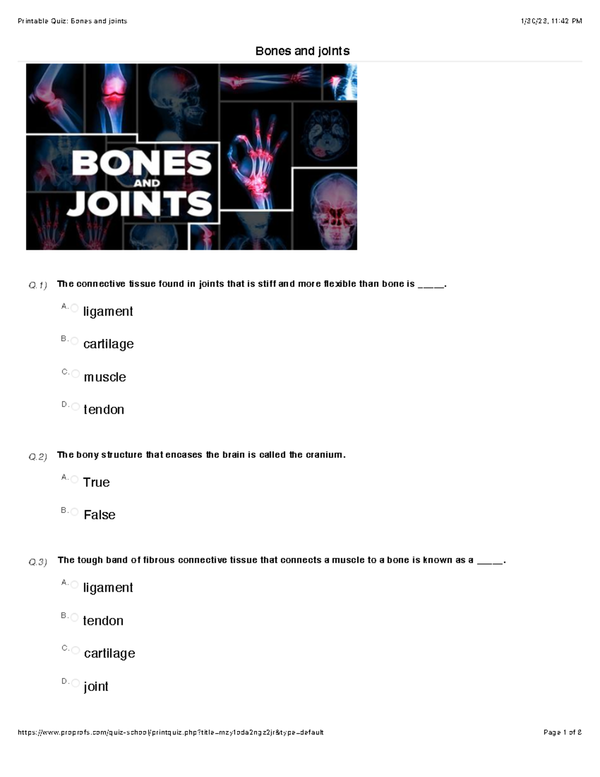 Bones and joints - This is a practice quiz to help you be successful ...