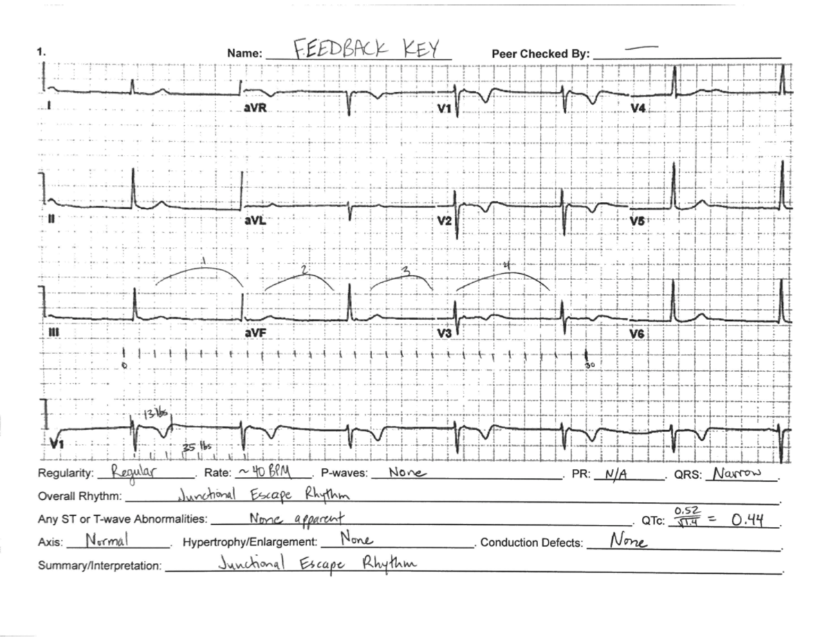 EKG Worksheet 6 - Feedback Key - MED 245 - Studocu