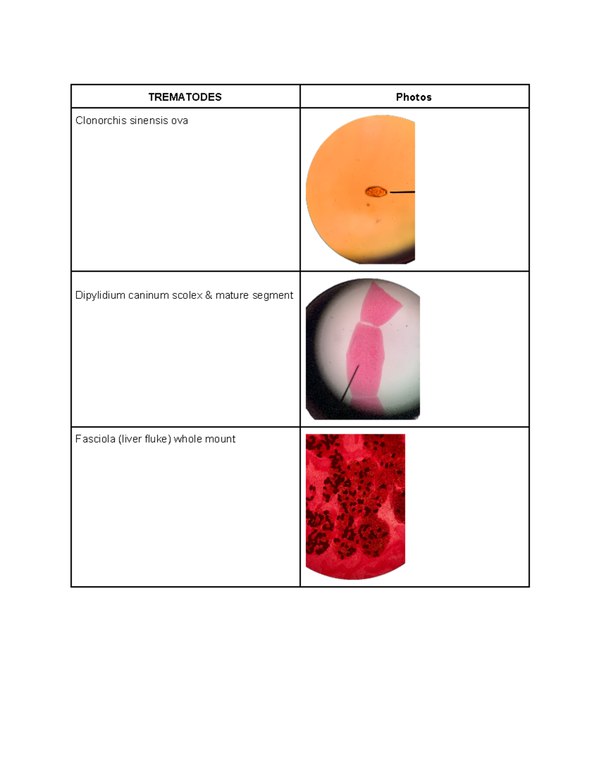 Micropara ACT 11 AND 12 - Microbiology Lab - TREMATODES Photos ...