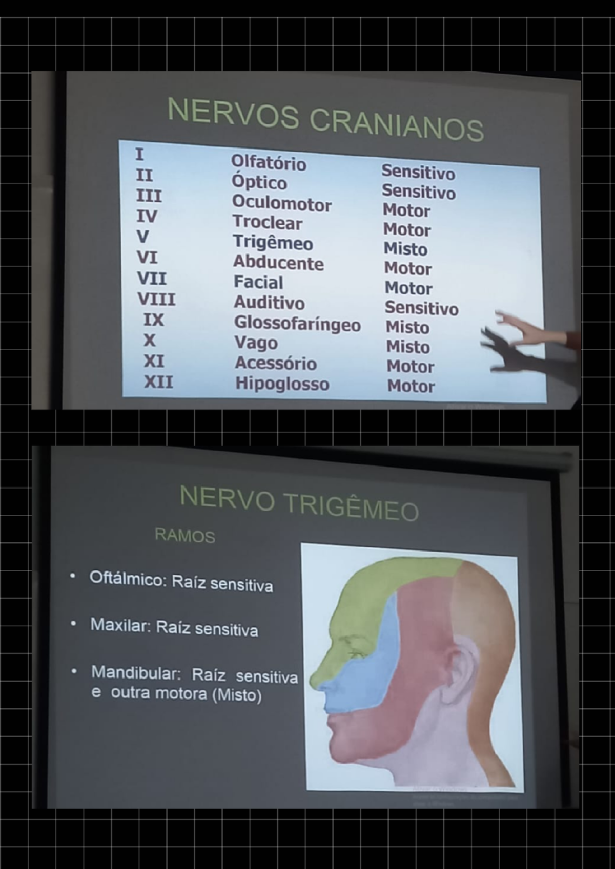 Inervação da face 240601 145622 (2) - NERVOS CRANIANOS I Olfatório ...