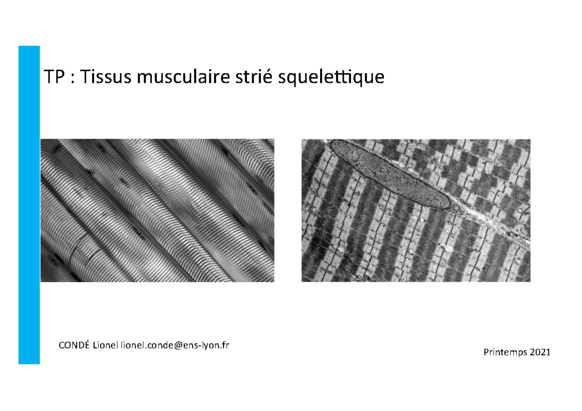 TP muscle striés squelettique L1 - TP : Tissus musculaire strié ...