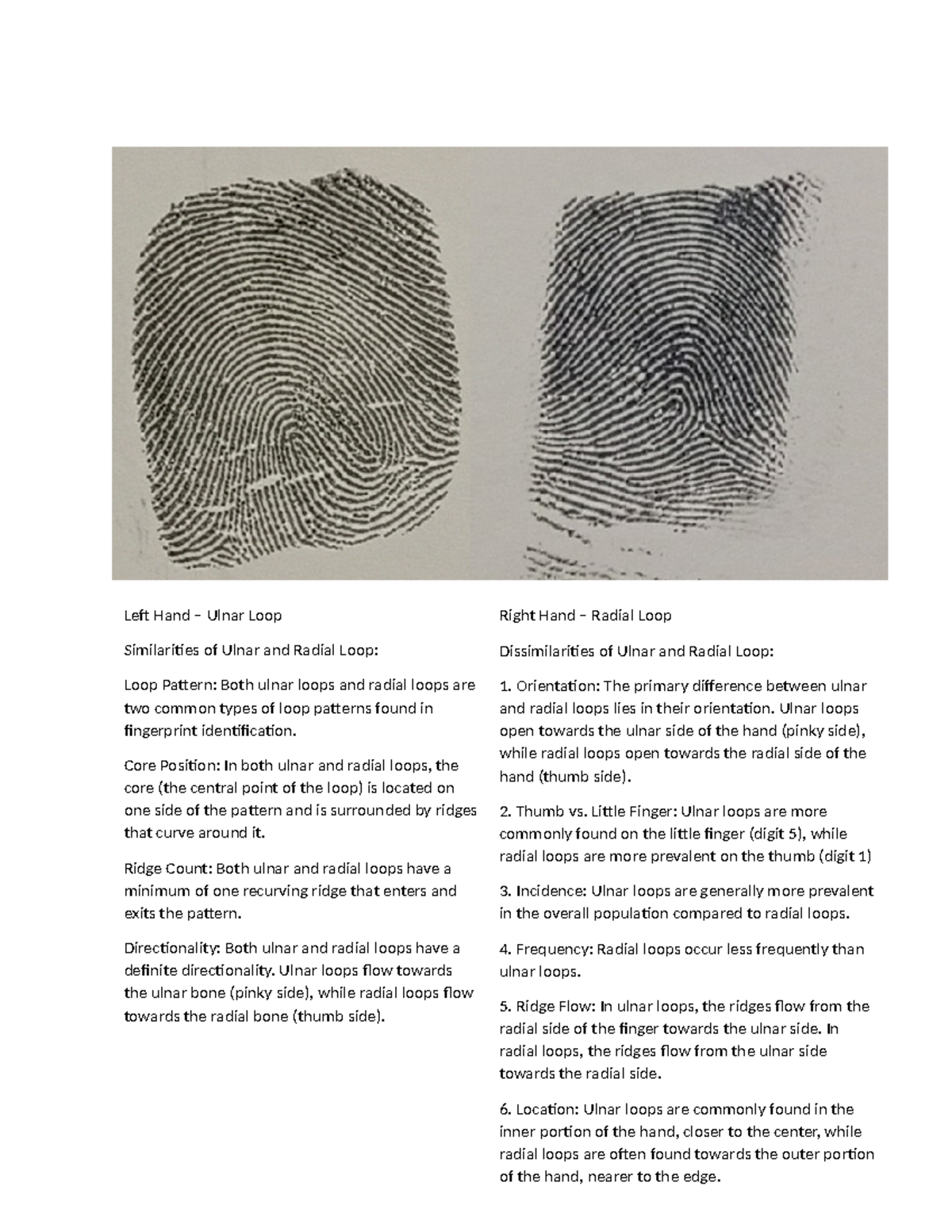 Final Req - Left Hand – Ulnar Loop Similarities of Ulnar and Radial ...