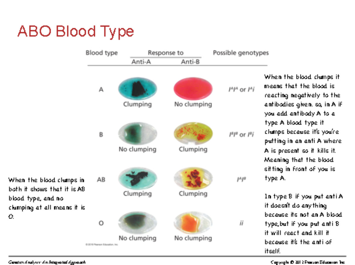 Genetics 2 9 - ABO Blood Type When the blood clumps it means that the ...
