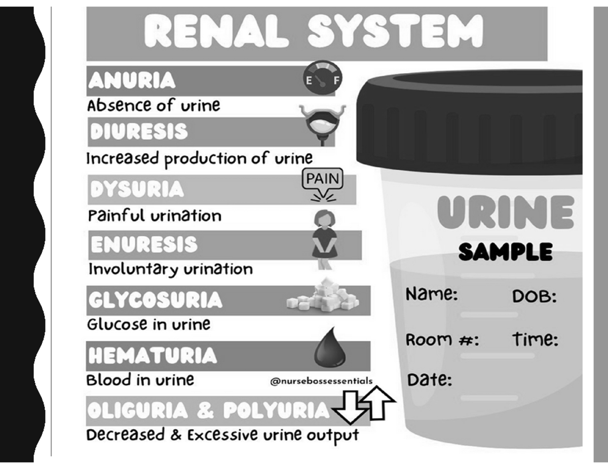 GU Renal Failure - ACUTE RENAL FAILURE ####### • ####### RIFLE ...