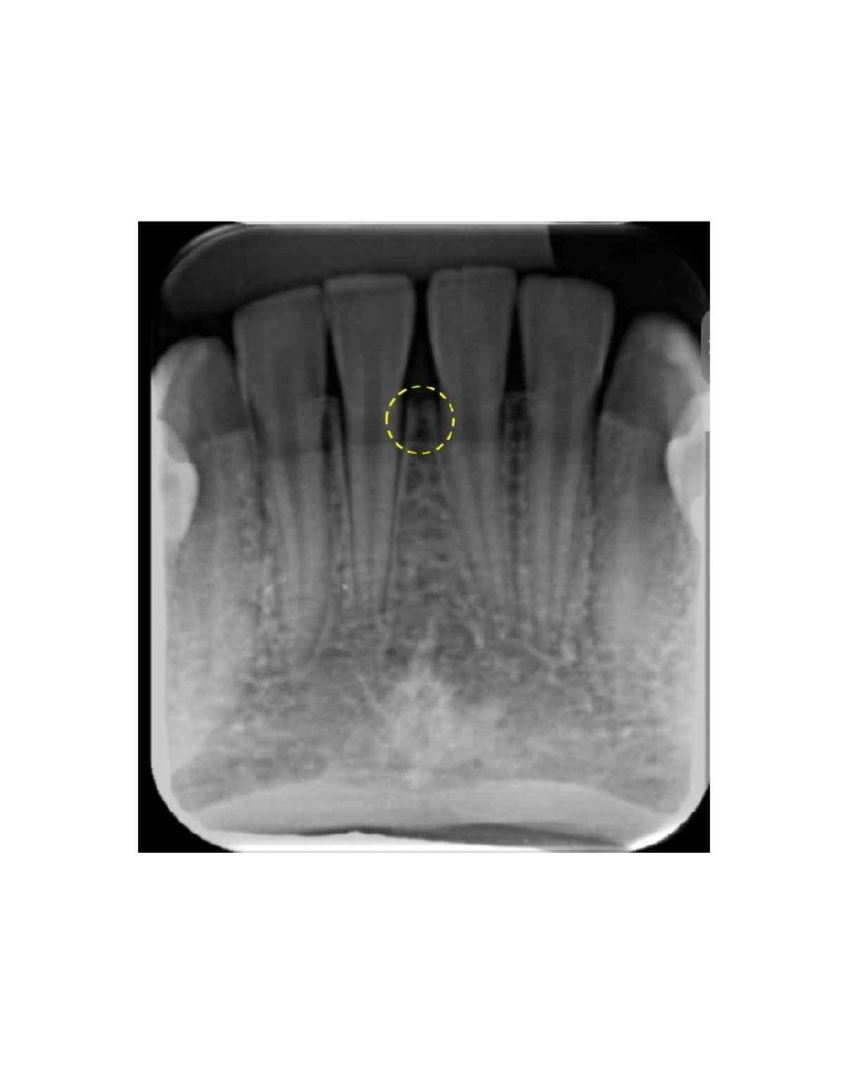 Estructuras anatomicas de radiografias periapicales - Odontology - Studocu
