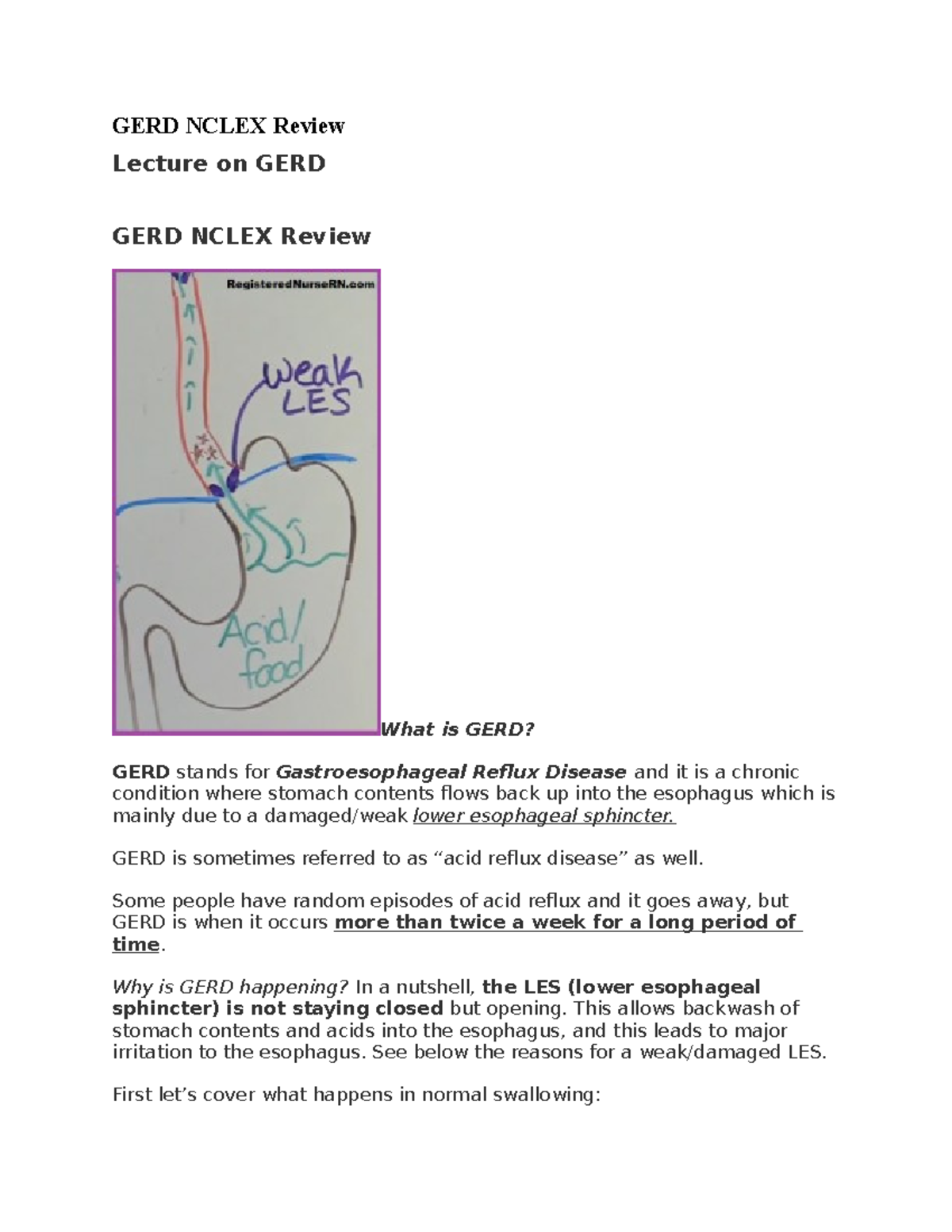 GERD Nclex Review - Professor Keller, helpful - GERD NCLEX Review Lecture on GERD GERD NCLEX ...