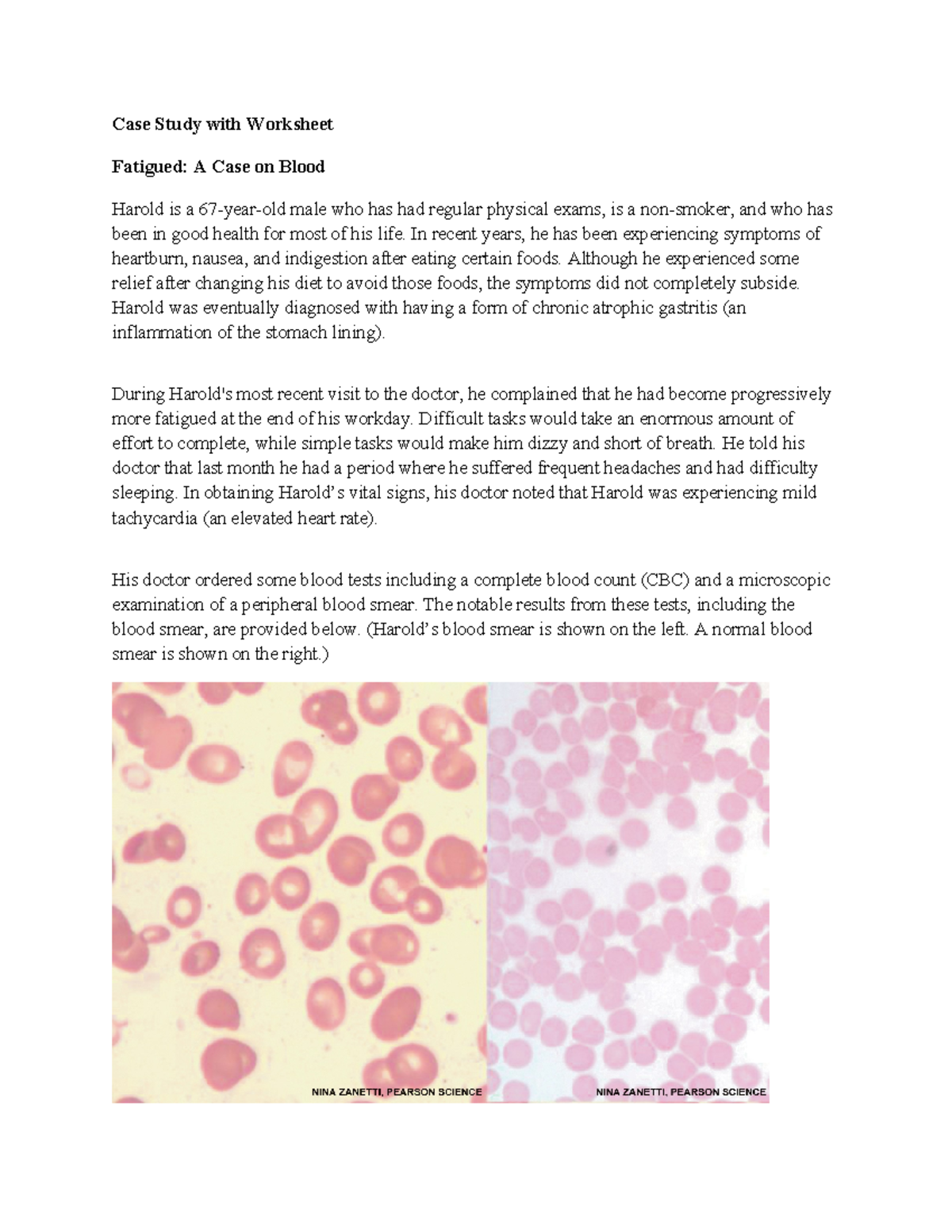Ch 17 Blood Case Study #2 - Case Study with Worksheet Fatigued: A Case ...