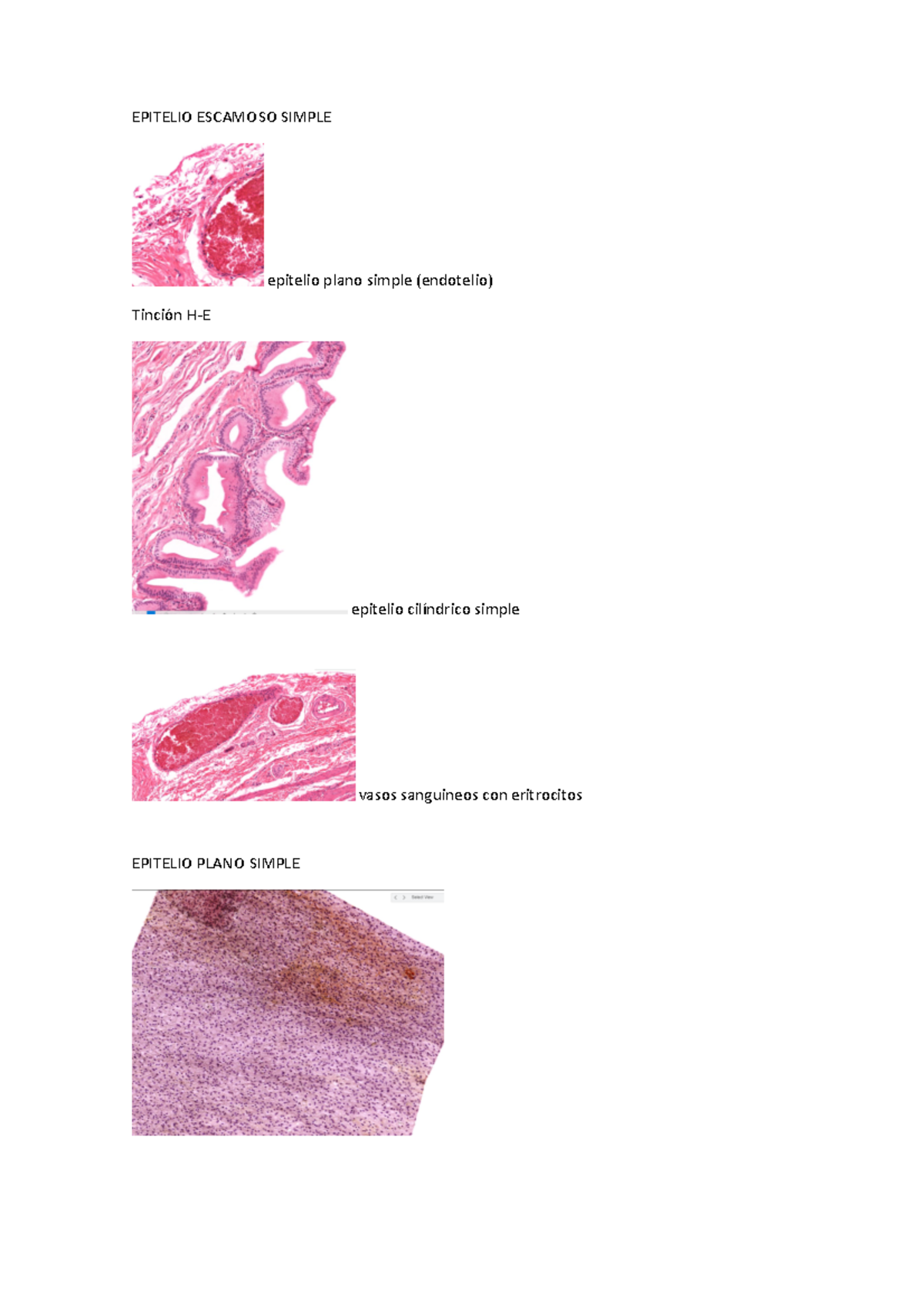 Practica 2 histologia pdf - EPITELIO ESCAMOSO SIMPLE epitelio plano ...
