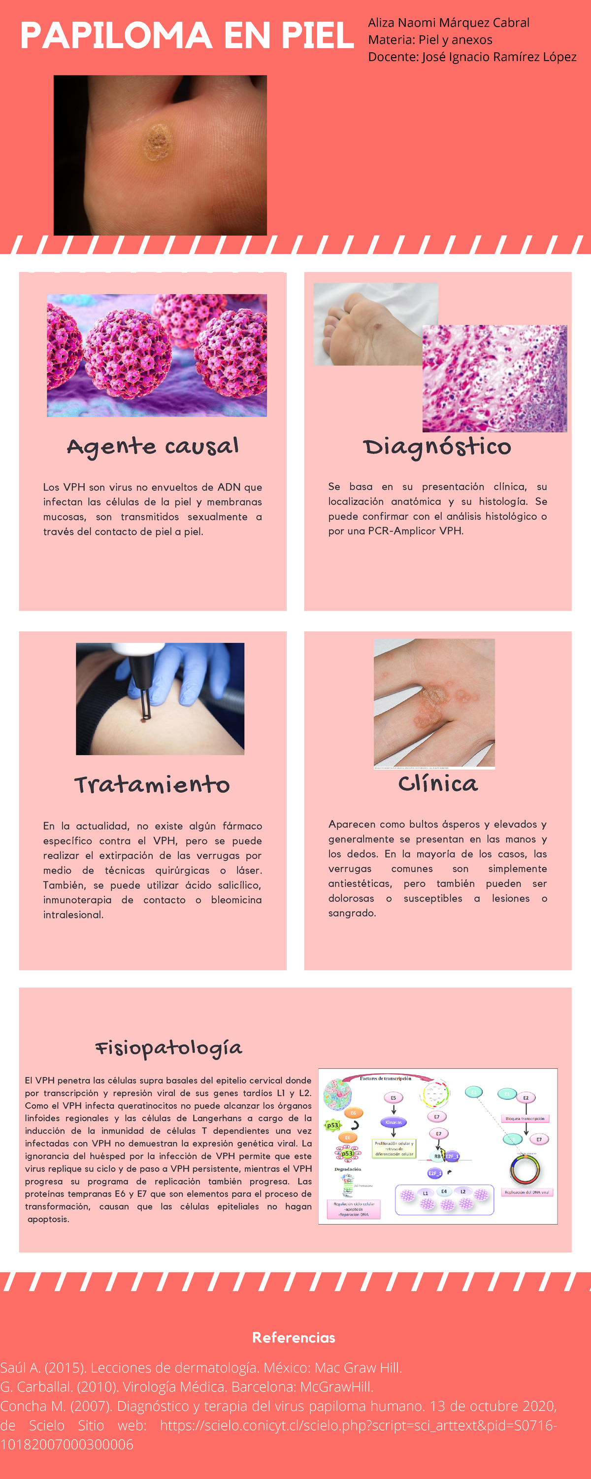 Papiloma en piel - Infografía - Fisiopatología El VPH penetra las ...