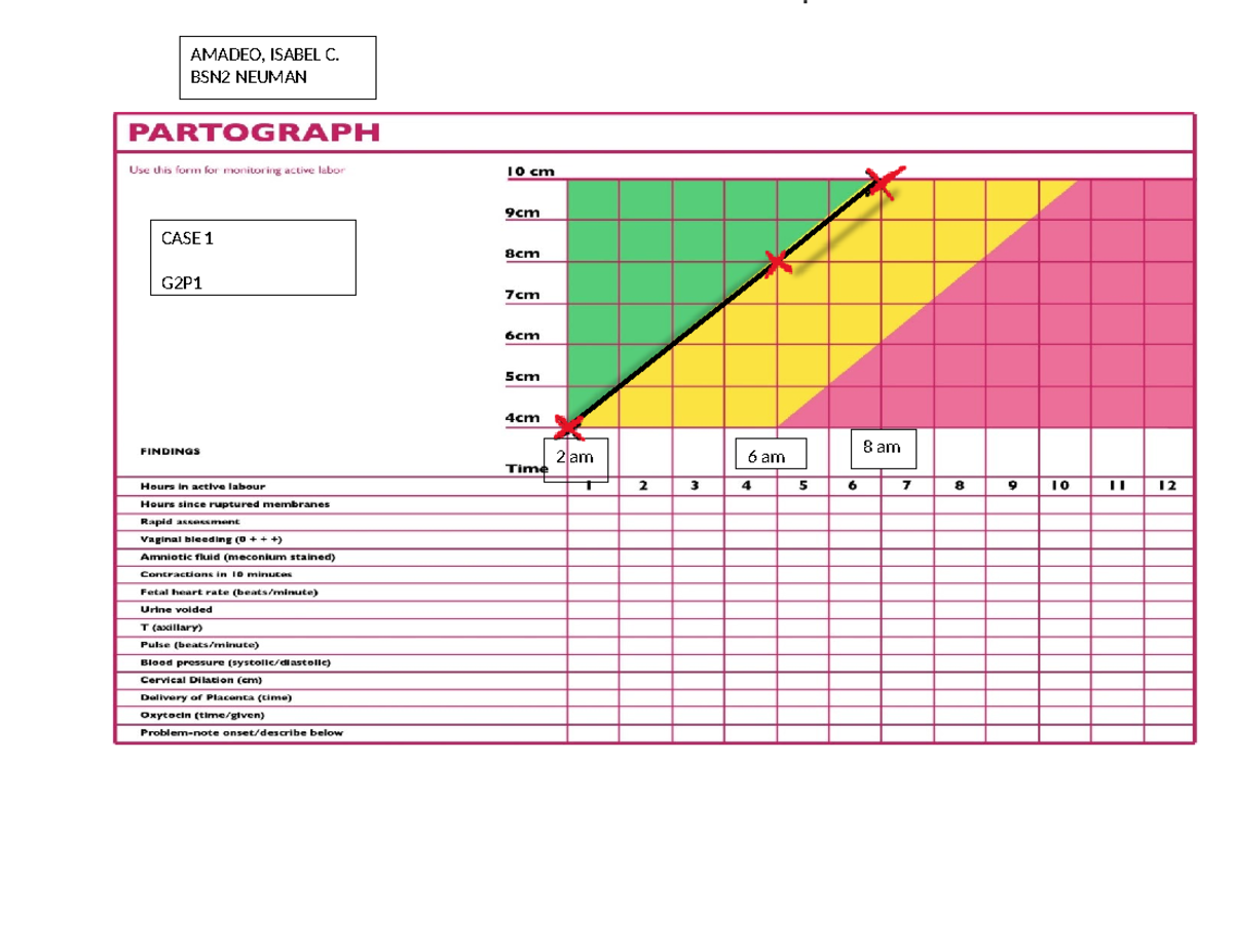 Partograph Activity - NOTES - Nursing - 2 am 6 am 8 am CASE 1 G2P ...