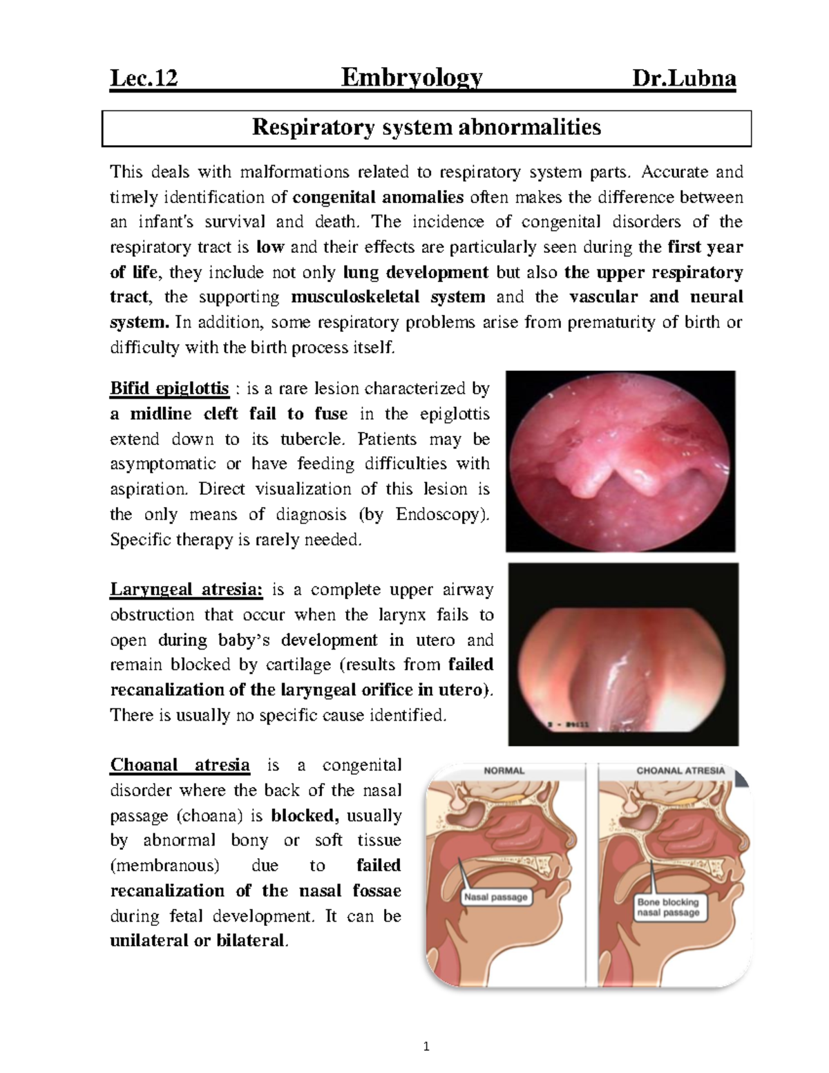 Respiratory system abnormalities - 1 Lec Embryology Dr Respiratory ...