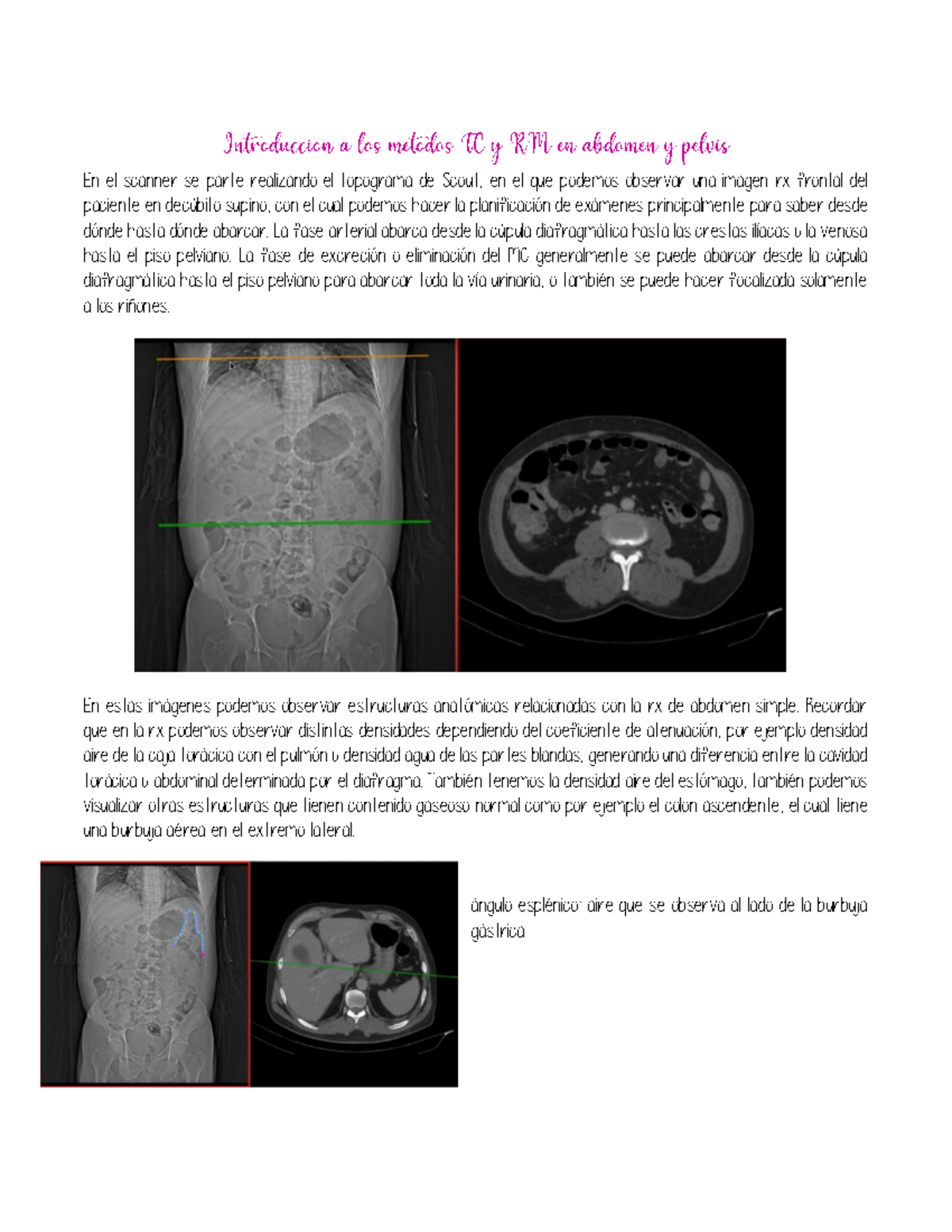 Introducción TC y RM en abdomen y pelvis - En el scanner se parte ...