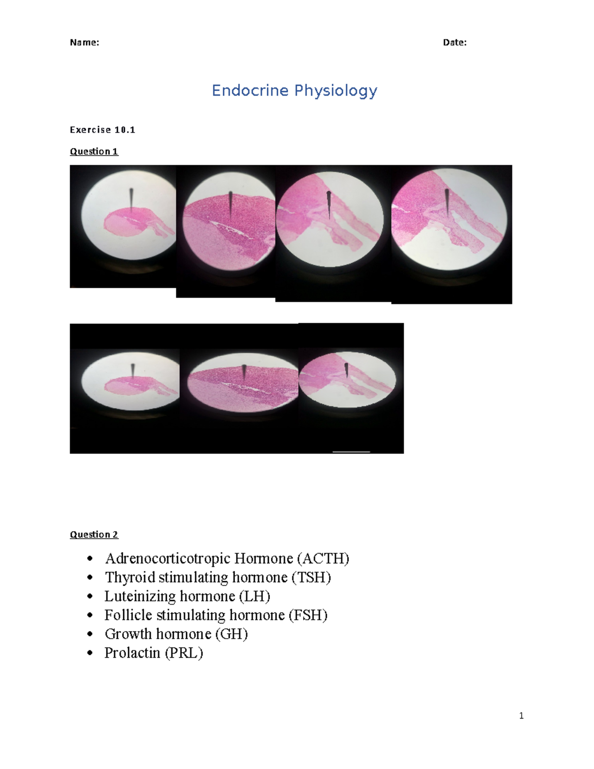 Endocrine Template - N/A - Endocrine Physiology Exercise 10. Question 1 ...