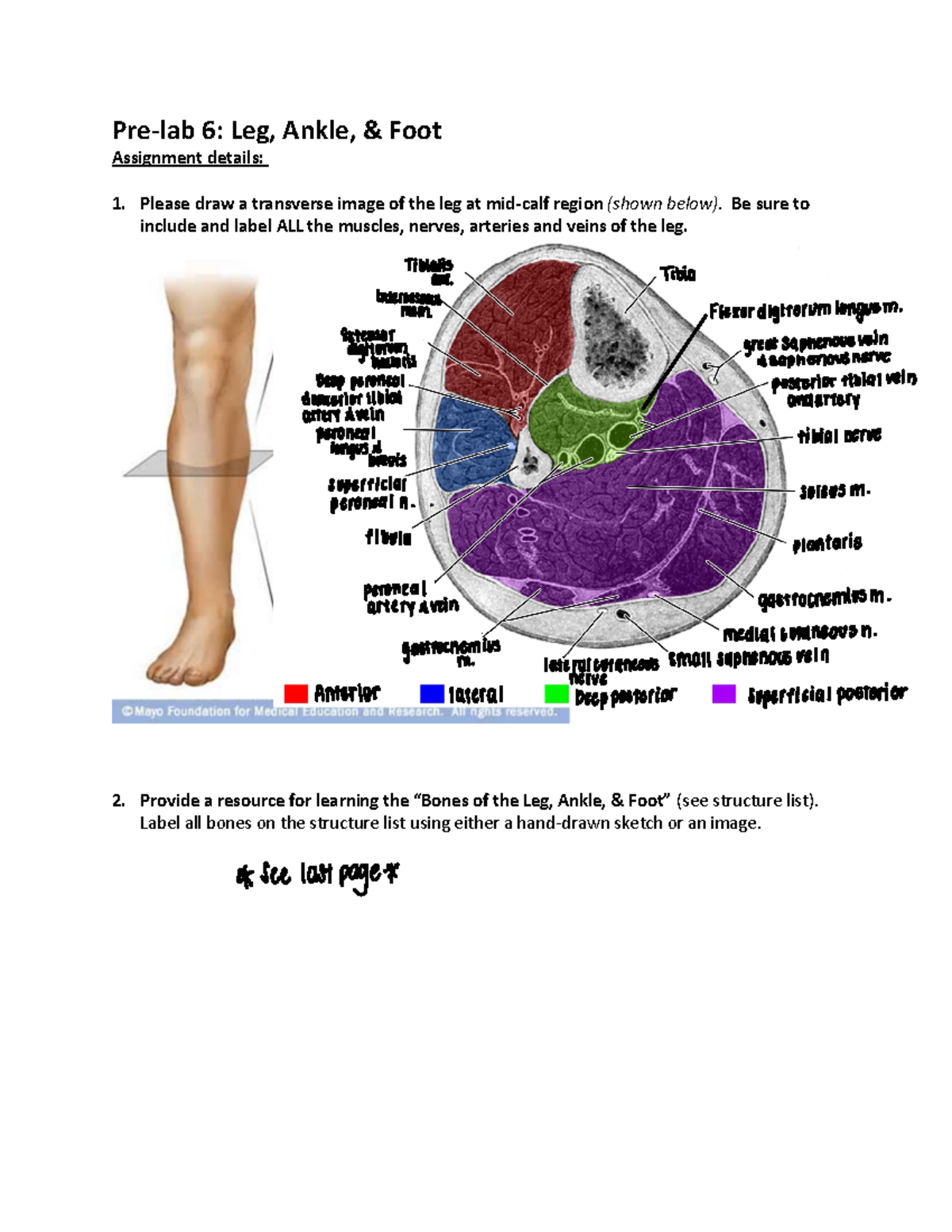 Prelab 6 copy - Pre-lab - Pre-lab 6: Leg, Ankle, & Foot Assignment ...