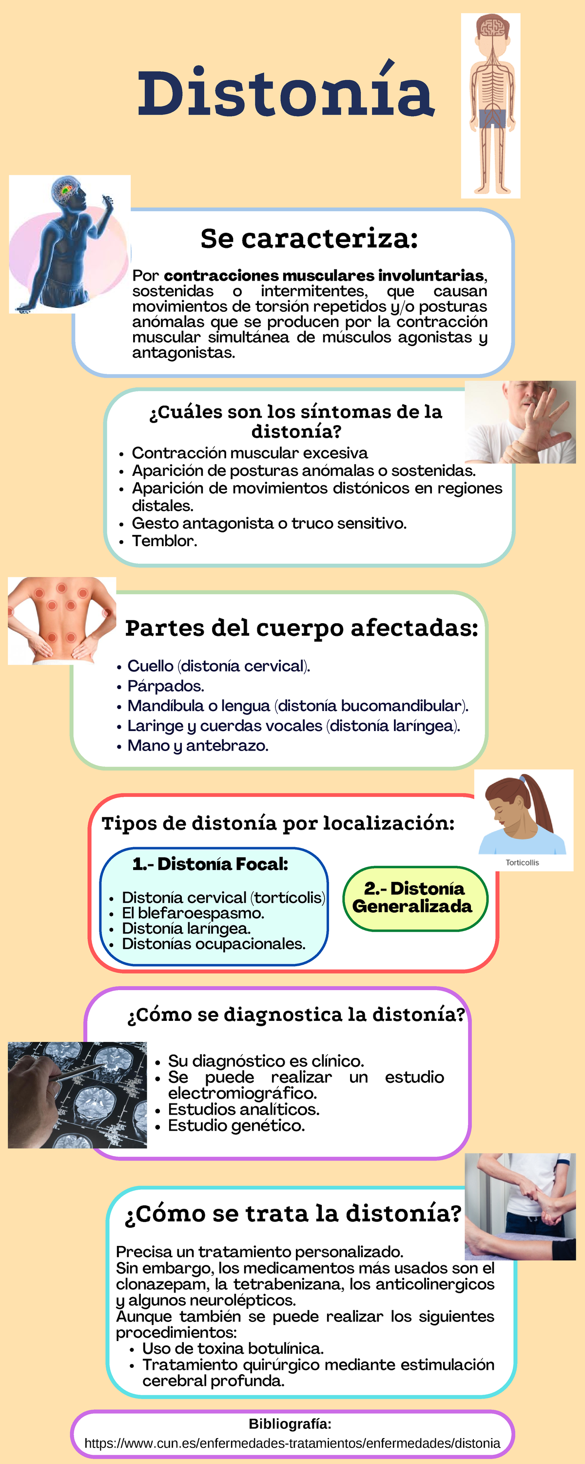 Distonía Generalizada