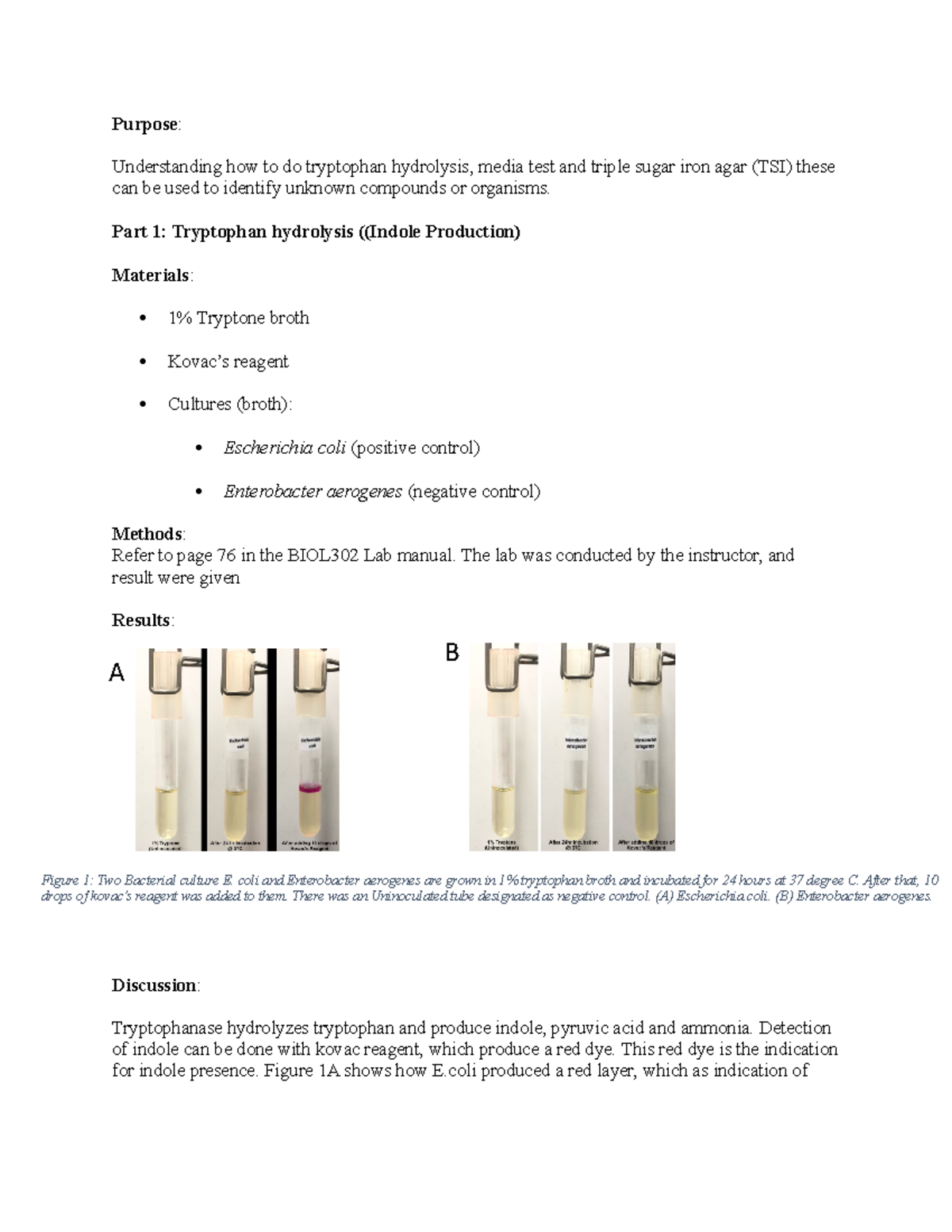 TSI, citrate , media - Purpose : Understanding how to do tryptophan ...