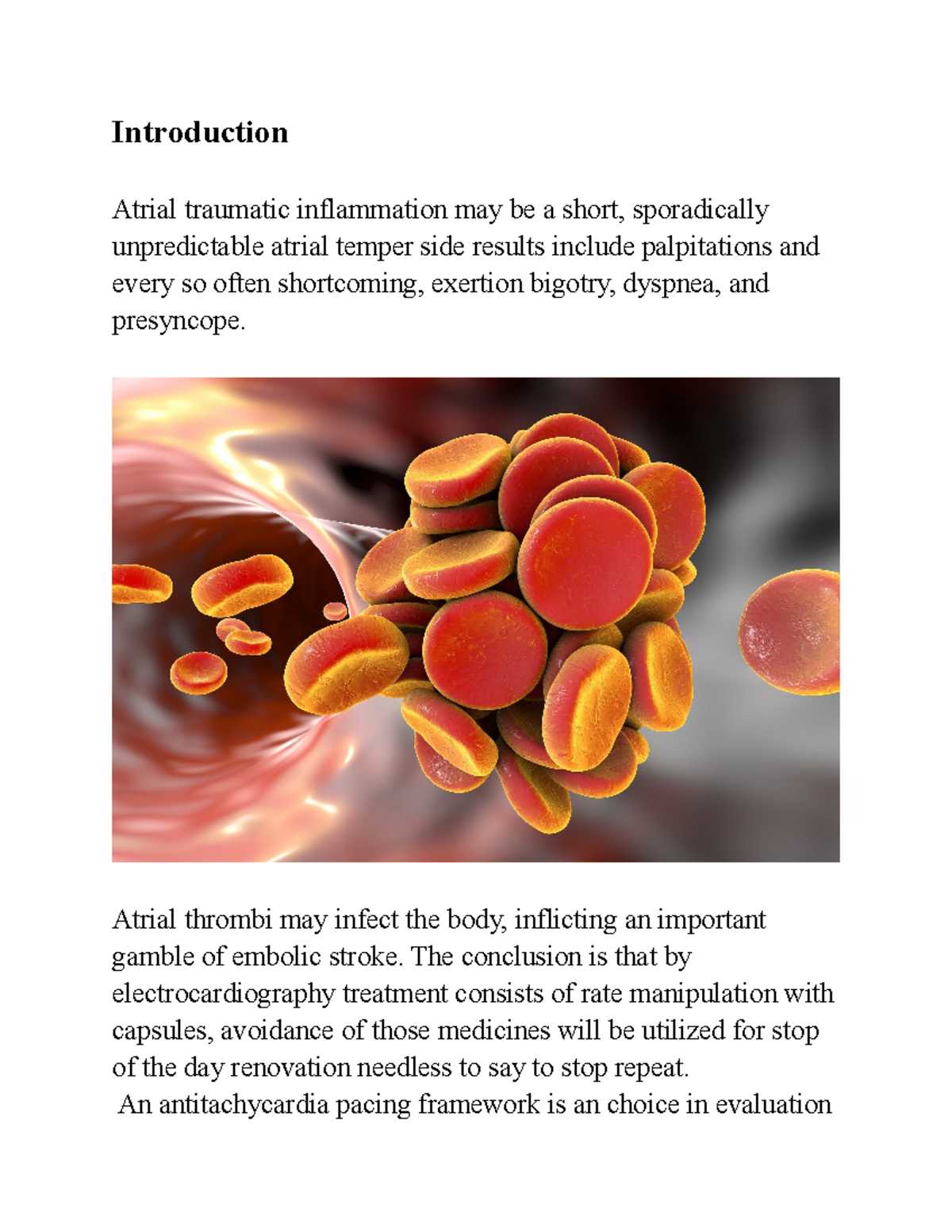 Atrial flutter pathology - Introduction Atrial traumatic inflammation ...