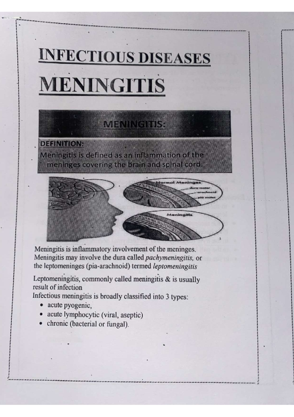 Meningitis - Simple notes to score very high score.. - Pharmacy - Studocu