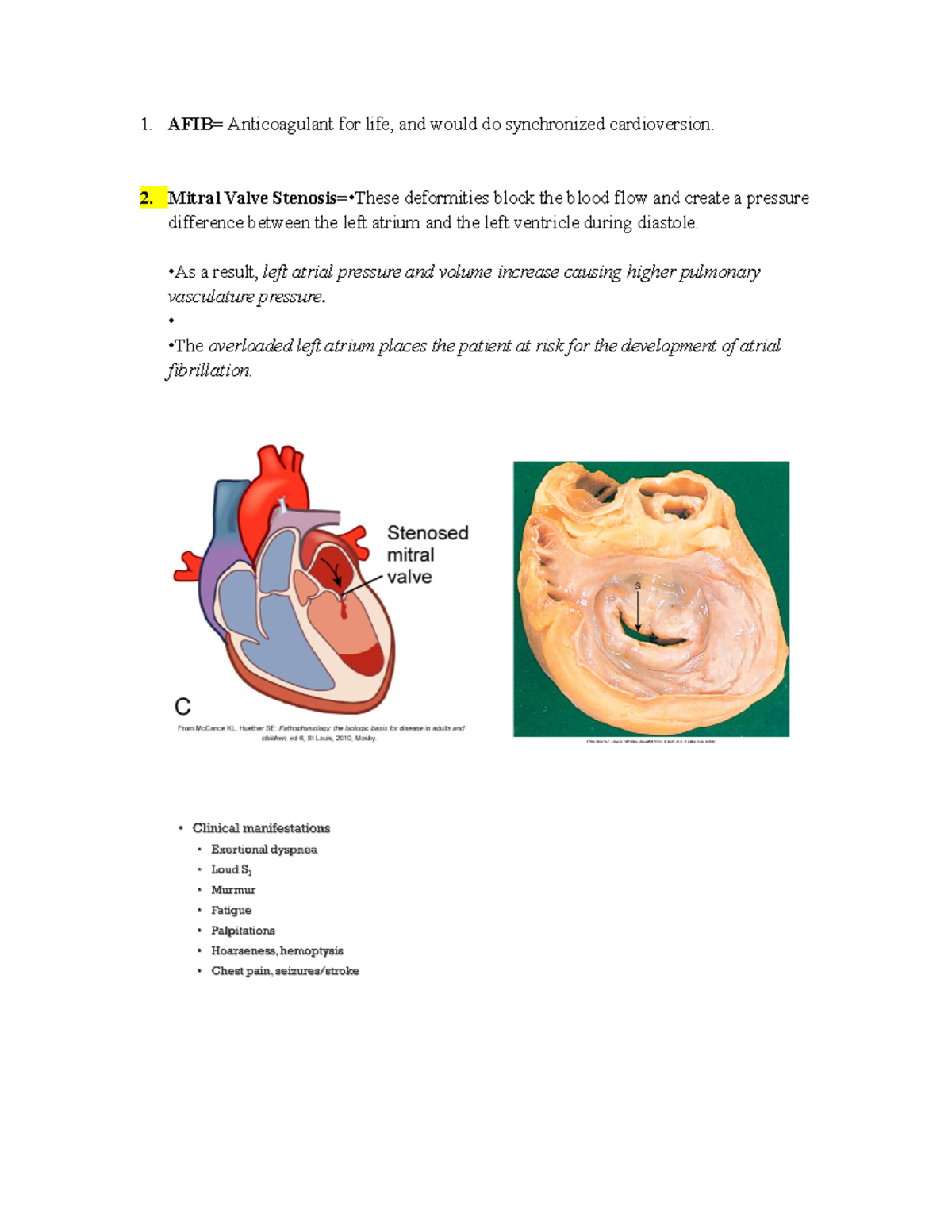 Sowells Review - AFIB=Anticoagulant for life, and would do synchronized ...