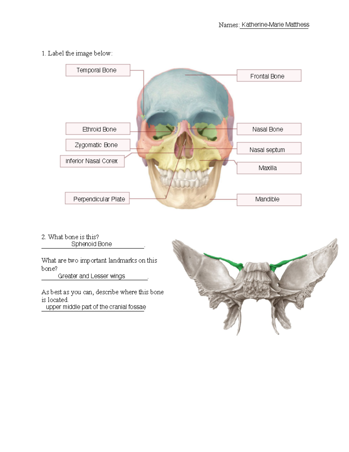 Axial Skeleton Worksheet - Label the image below: What bone is this