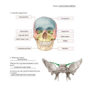 Appendicular Skeleton Worksheet - Names:____________________ Label the ...