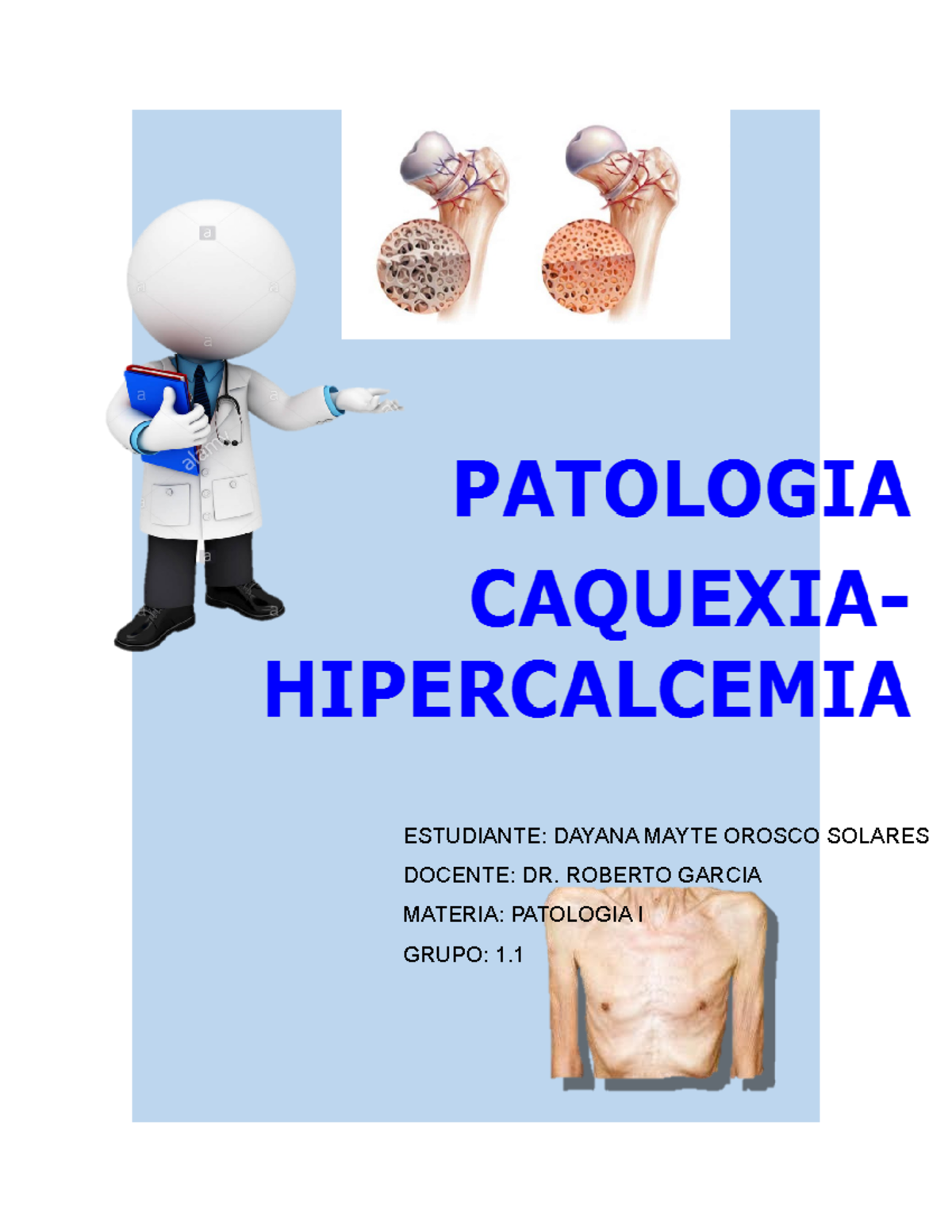 - Sindromes Paraneoplasicos - CAQUEXIA ESTUDIANTE: DAYANA MAYTE OROSCO ...