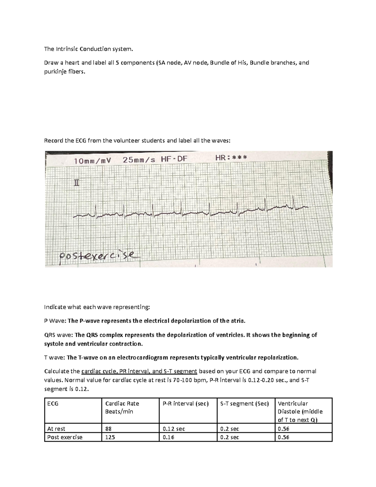 Cardio Group Work - The Intrinsic Conduction system. Draw a heart and ...
